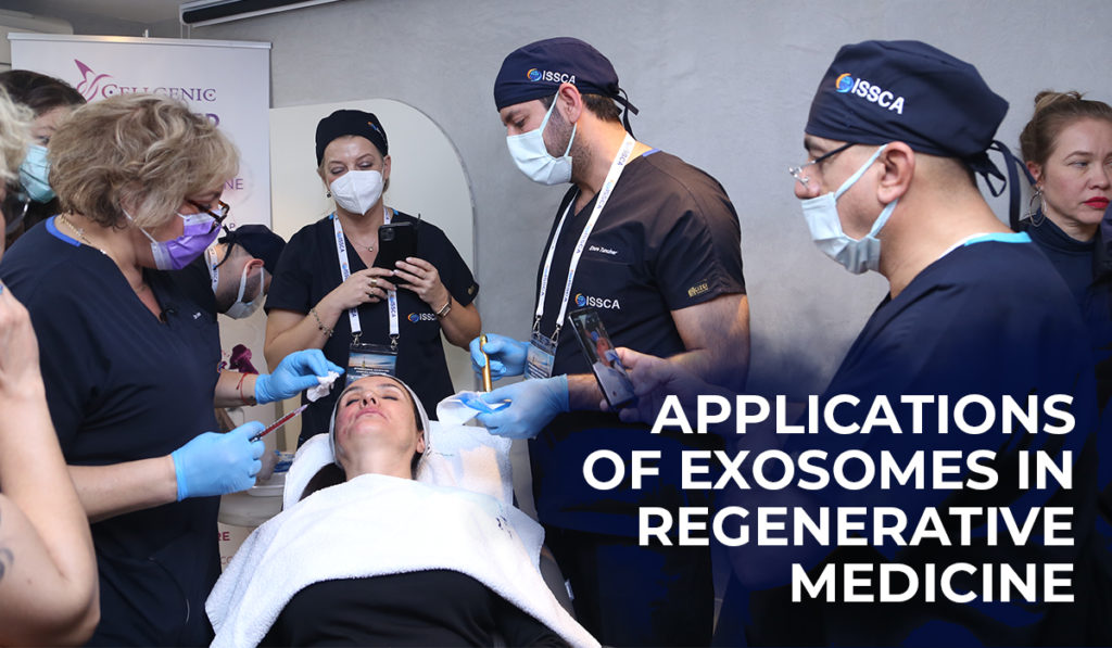 Applications of Exosomes in Regenerative Medicine – Stem Cells Lab